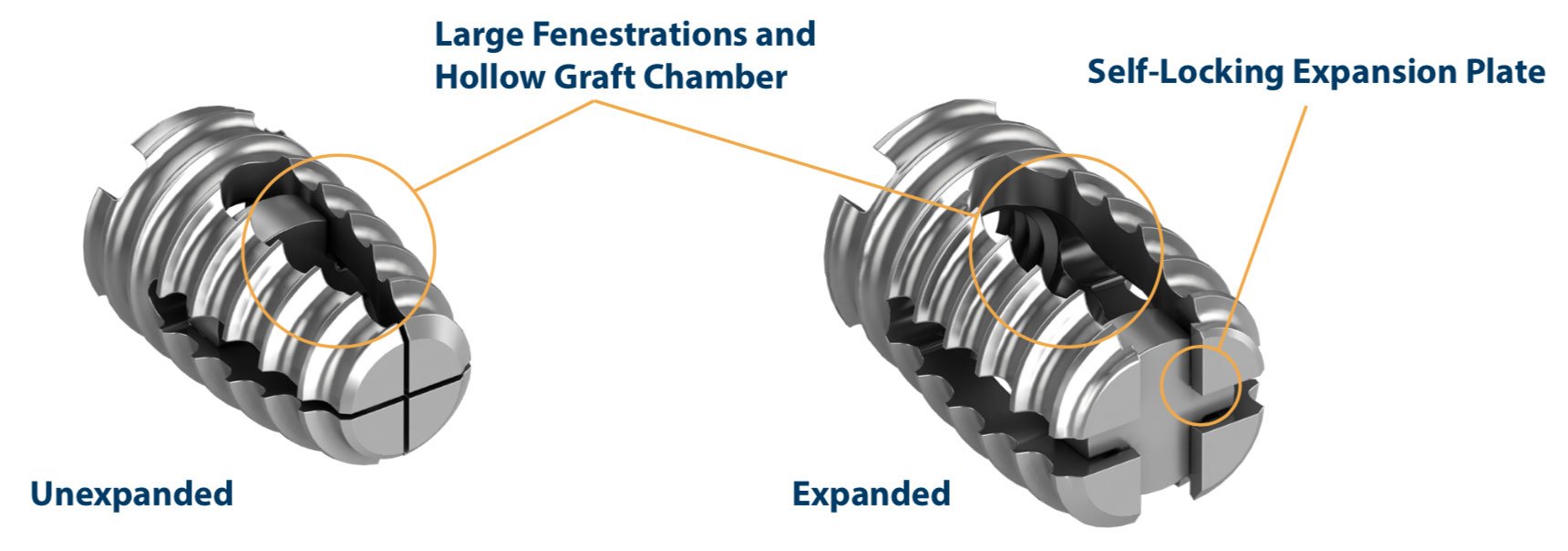 Wenzel Spine Announces FDA 510K Clearance for VariLift-C