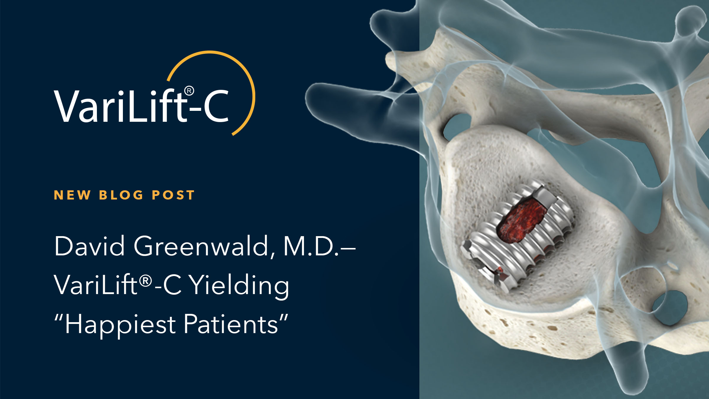 David Greenwald, M.D.— VariLift®-C Yielding “Happiest Patients”